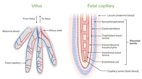 Placental Abnormalities Concise Medical Knowledge
