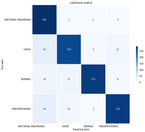 Github Ovisarkar Chest Xray Classification Utilizing Cnn With Optimized Hyperparameters A