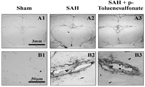 Ab Representative Photomicrographs Showing Immunohistochemistry For Download Scientific