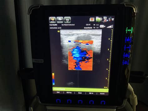 Ge 12l 12l Sc Linear Array Ultrasound Transducer Probe For Venue 40 Auschoice