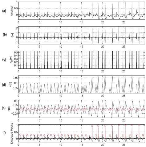 Figure 4 From A Simple And Robust Qrs Detection Algorithm For Wireless