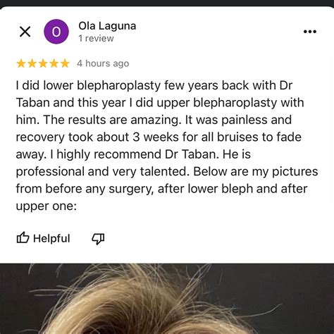 Mehryar Ray Taban Md Oculoplastic Surgeon Eyesbytaban Upper Eyelid