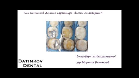 Батинков Дентал -Прозрачност и гаранция за качество - YouTube