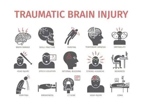 Types Of Brain Injuries The Bishop Law Firm