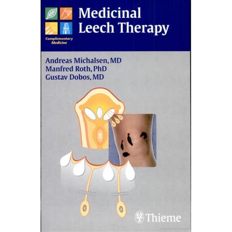 Medicinal Leech Therapy Herbs And Touch