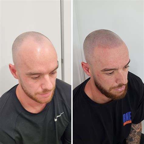 Hair Tattoo