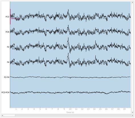 Identify Eeg Electrodes Bridged By Too Much Gel — Mne 180 Documentation