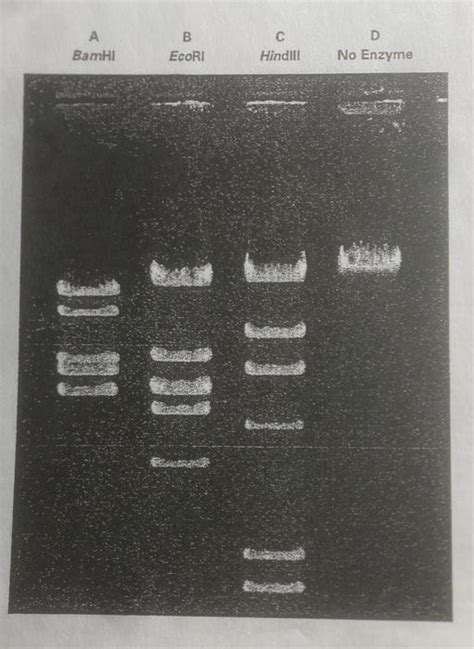 Ideal Restriction Digest Of Lambda Dna 4 Tona