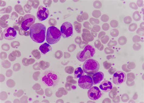 A Precursor Cell Also Called A Blast Cell Or Simply Blast Is A Stock