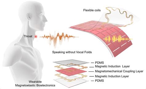 Speaking Without Vocal Cords Thanks To A New Ai Assisted Wearable