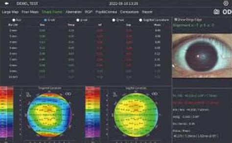 Ocular Diagnostic Master Dry Eye Diagnostic System Latest Price
