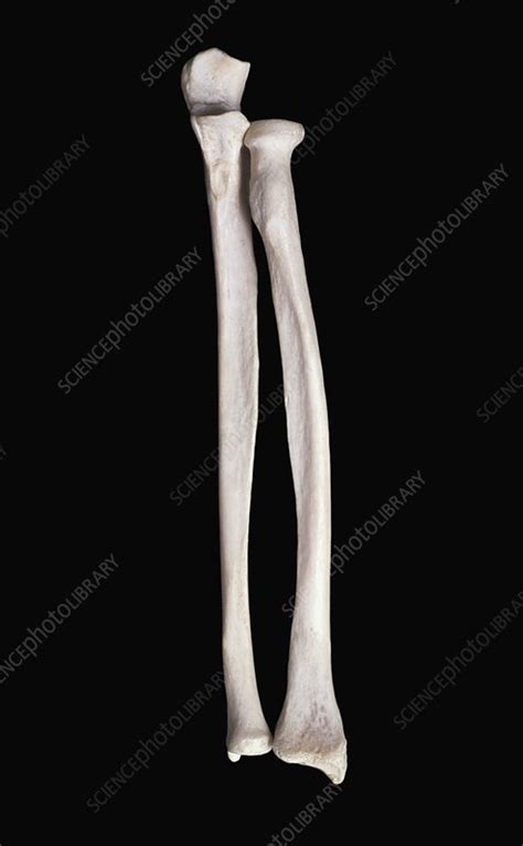 Real Radius Bone