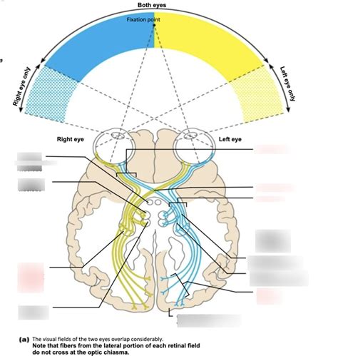 Figure 1614 Visual Pathway To The Brain And Visual Fields Inferior