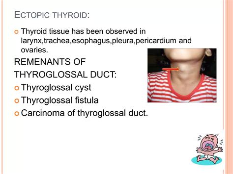 Development Of Tongue And Thyroid Gland Pptx