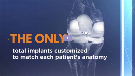 Custom Partial And Total Knee Replacement Washington Dc Bethesda Md