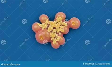 Impetigo Is An Infection Caused By Strains Of Staphylococcus Or