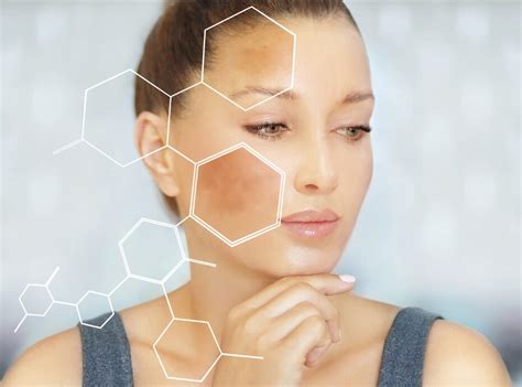 Faciems Approach To Hyperpigmentation Faciem Dermatology And Medical