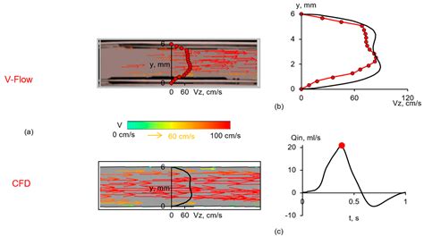 V Flow Measurements Of Pulsatile Flow In Femoral Popliteal Bypass