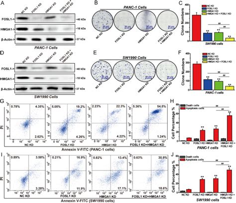 Fosl1 Drives The Malignant Progression Of Pancreatic Cancer Cells By