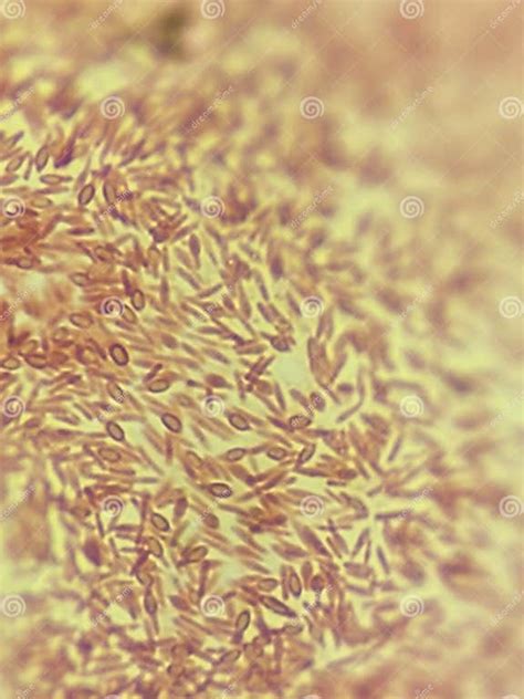 Bacillus Spore Forming Bacteria Stained Microscopic View Stock Image