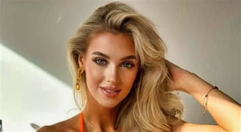 Tom Bradys Model Superfan Veronika Rajek Suffers Injuries