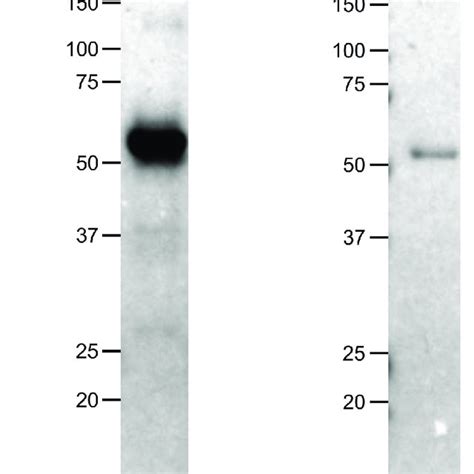 Immunoprecipitation Ip Western Blotting Wb Of Saliva Samples From
