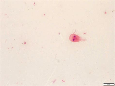 Creepy Dreadful Wonderful Parasites Case Of The Week 413