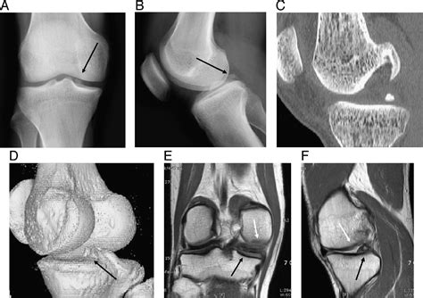 Case Report Knee At Terri Greaves Blog