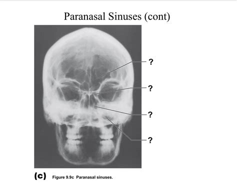 Paranasal Sinuses Diagram Quizlet