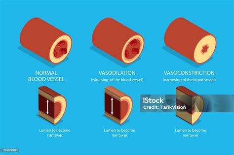 3d Isometric Flat Vector Illustration Of Vasoconstriction And