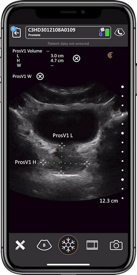 Pocus In Urology 5 Ways To Streamline Patient Care Clarius