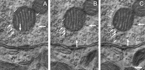 Mitochondria Electron Microscope