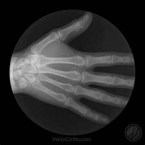 Hand X Ray Imaging Orthopedic Diagnostic Reference 1749006 Clipart