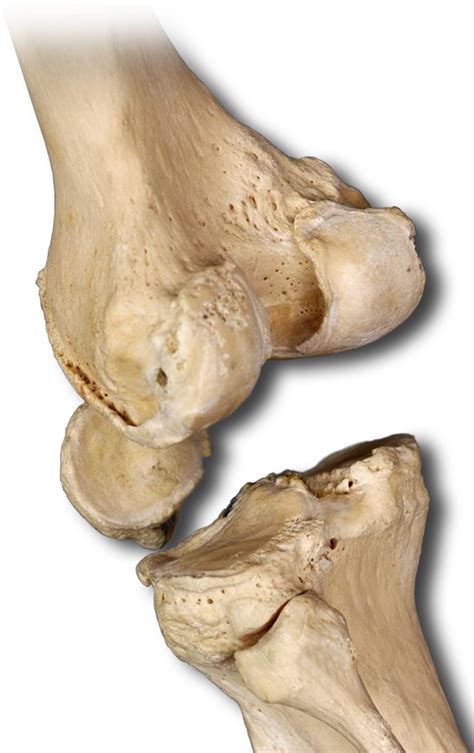 Lower Extremities Bones