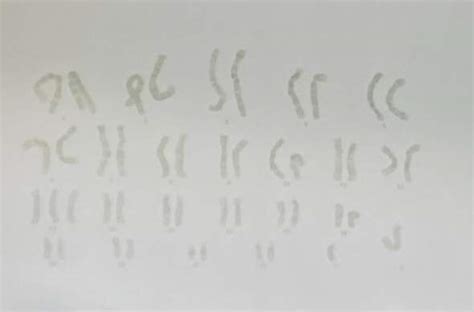 Geschlecht Von Einem Karyogramm Ablesen Genetik Dna Biologieunterricht