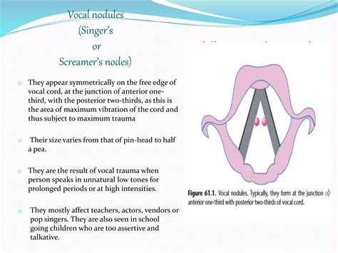 Vocal Cord Nodule Pptx