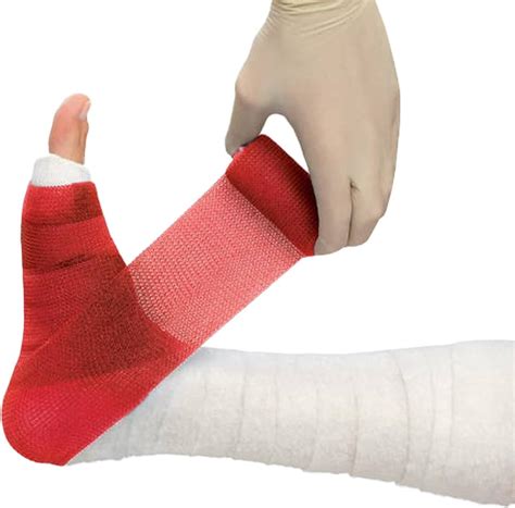 Fiberglass Cast Sizes At Celia Morgan Blog
