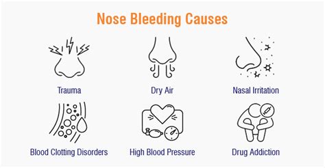 Nose Bleeding Symptoms Causes Treatment And Prevention