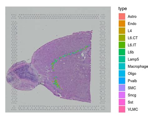 10x单细胞空间联合分析之三 Spotlightspotlight分析 Csdn博客