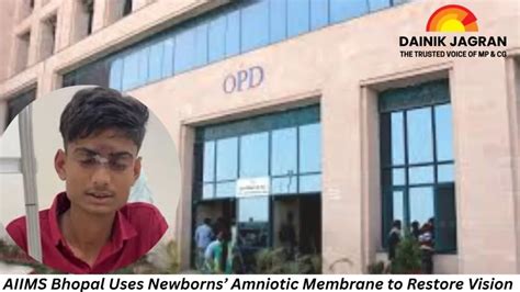 Amniotic Membrane From Newborns Restores Eyesight Of Carbide Gun