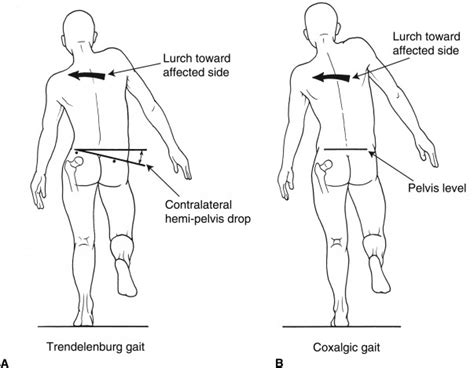 Ipsilateral Versus Contralateral What Arm And Leg Combination To Use