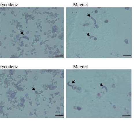 Comparison Of The Degree Of Red Blood Cell Contamination Using Two