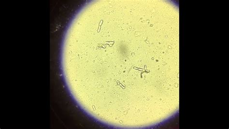 Ever Wonder What Giardia Looks Like Under A Microscope Here Is A Video