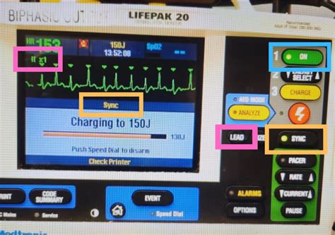 Synchronized Cardioversion Cpr Done Right Cpr Acls Bls Pals Nrp