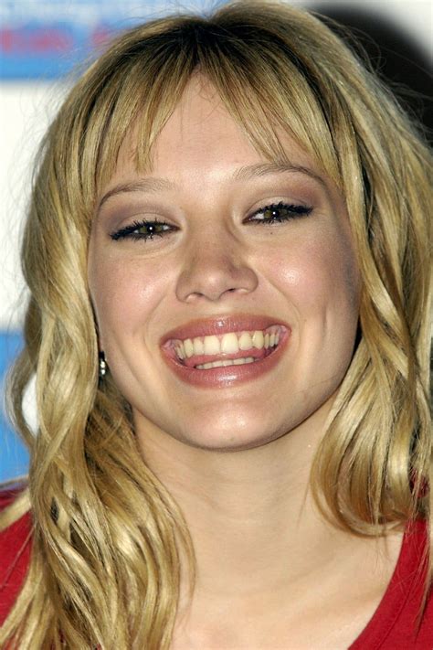 Porcelain Veneers Hilary Duff
