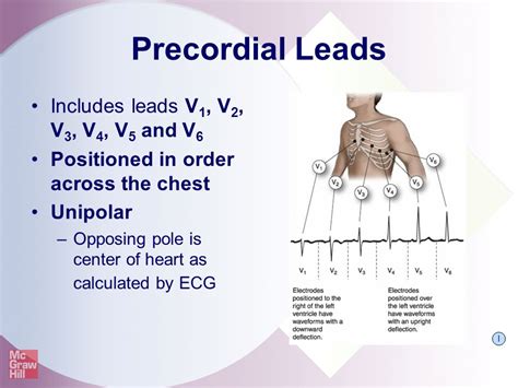 The Electrocardiogram Ppt Video Online Download
