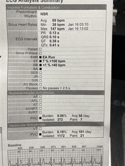 7 Day Monitor R Pvcs