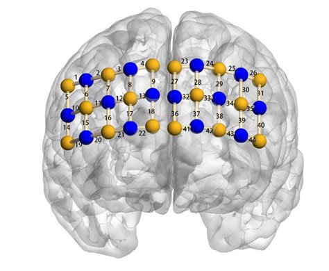 Localization Of Regions Of Interest Note Ventrolateral Prefrontal