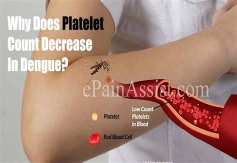 Why Does Dengue Virus Cause Decrease ⁶in Platelet Count The Indian Wire