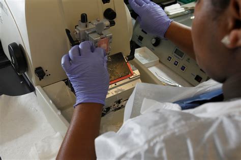 Lab Company Lays Off More Workers At N J Headquarters As Labcorp Takes Over